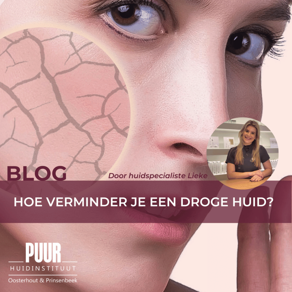 Hoe verminder je een droge huid? - Schoonheidssalon "PUUR Huidinstituut ...