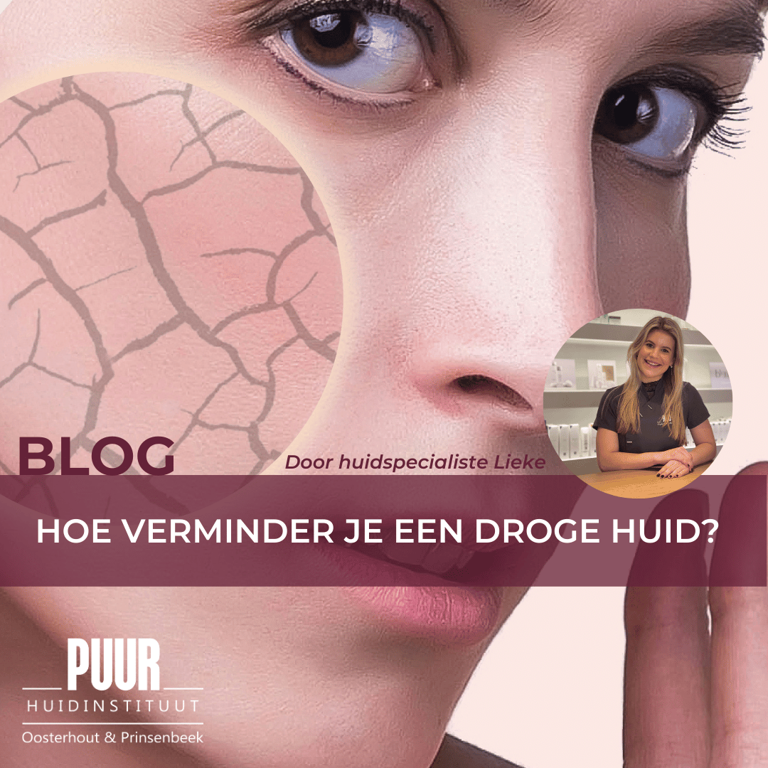 Hoe verminder je een droge huid? - Schoonheidssalon "PUUR Huidinstituut ...